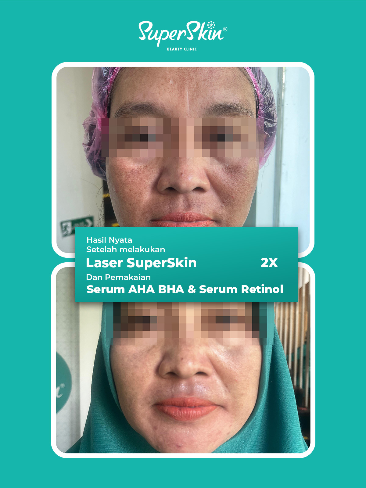 Beranda | Superskin